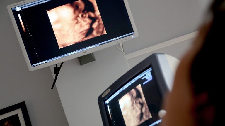 ¿Cuándo empieza a latir el corazón del feto? - WebSalud